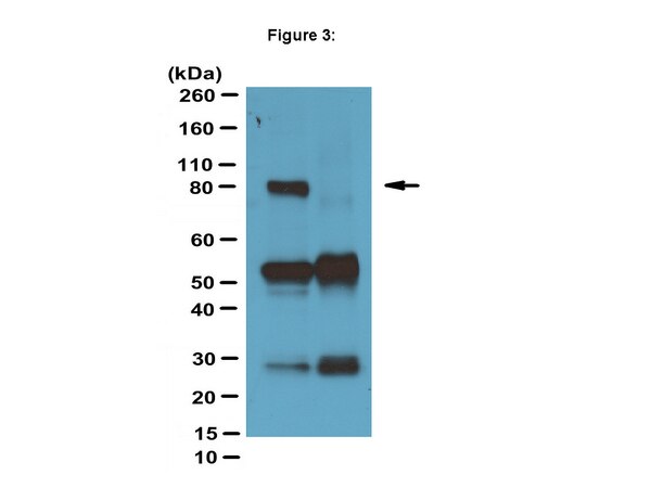 ChIPAb+ EZH2, clone AC22 - ChIP Validated Antibody and Primer Set | 17-662